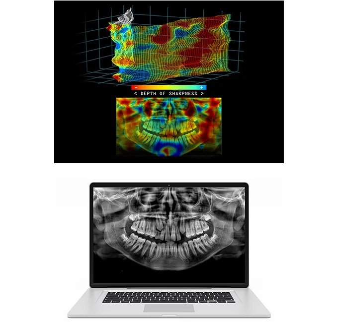 Panoramici CS 8100 Carestream | Odonto service