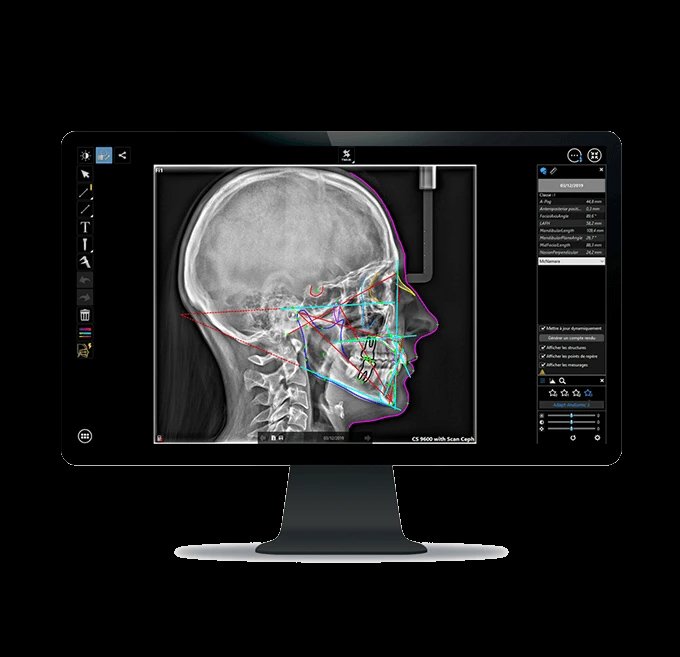 Panoramici CS 8100 Carestream | Odonto service